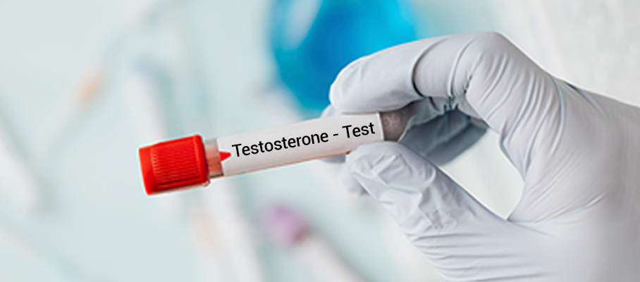 Testosterone Test: Purpose, When do you need it & What Does it Tell You
